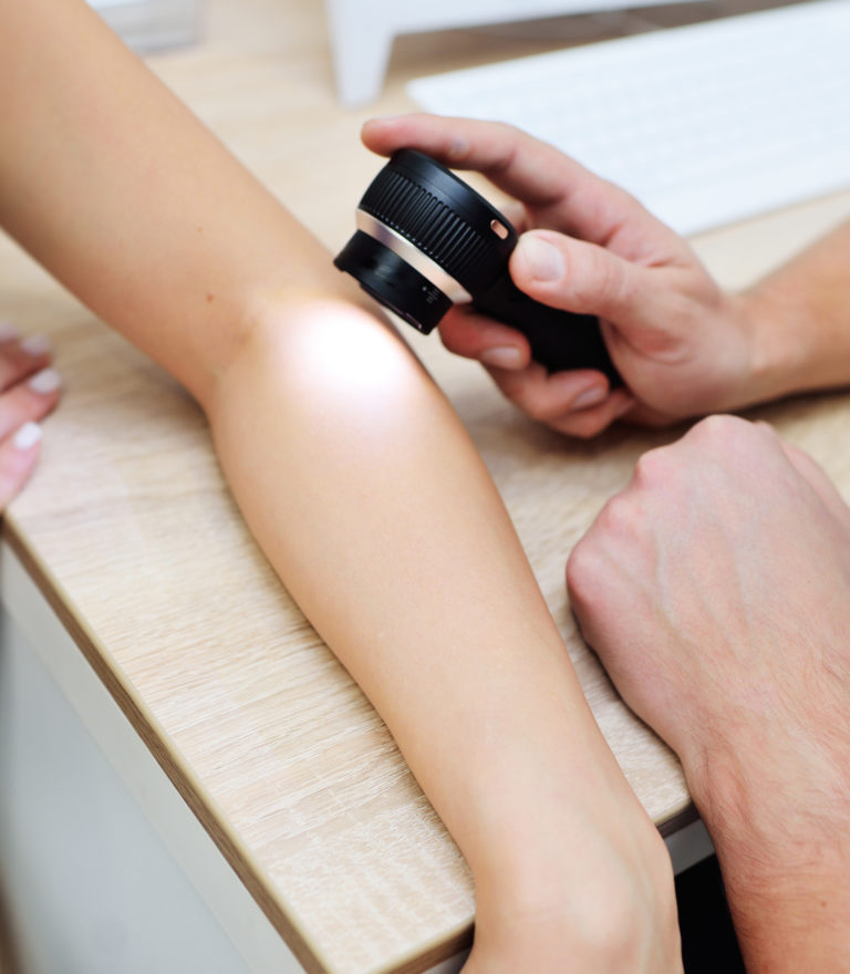 Corporate Skin Checks | Onsite Skin Cancer Checks | HCA